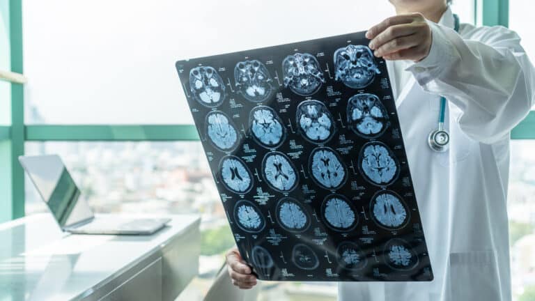 What Is CTE? - Nashville, TN - Labrum Law Firm Personal Injury Lawyers